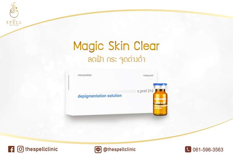 ลดเลือนฝ้ากระ Magic Skin Clear | The Spell Clinic